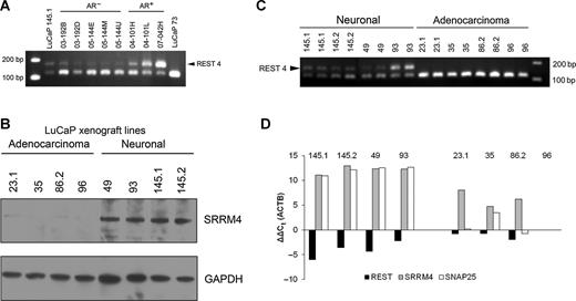 SRRM4 Expression and the Loss of REST Activity May Promote the ...