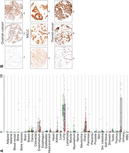 Preclinical Development of an Anti-NaPi2b (SLC34A2) Antibody–Drug Conjugate as a Therapeutic for ...