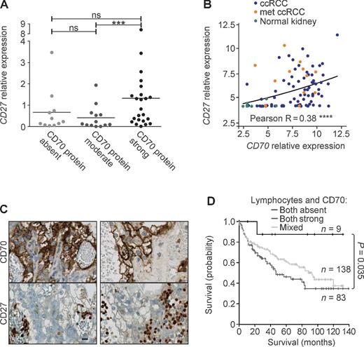 pVHL/HIF-Regulated CD70 Expression Is Associated with Infiltration of ...
