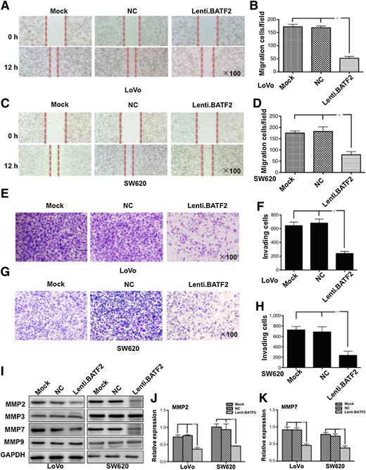 BATF2 Deficiency Promotes Progression in Human Colorectal Cancer via ...