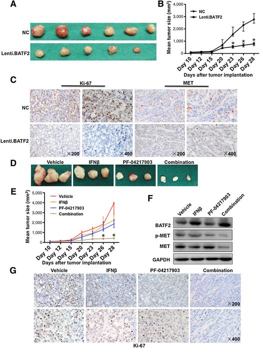 BATF2 Deficiency Promotes Progression in Human Colorectal Cancer via ...