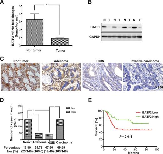 BATF2 Deficiency Promotes Progression in Human Colorectal Cancer via ...