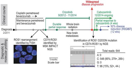 A Novel Crizotinib-Resistant Solvent-Front Mutation Responsive to ...