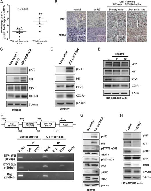 Kit Exon 11 Codons 557 558 Deletion Mutation Promotes Liver Metastasis
