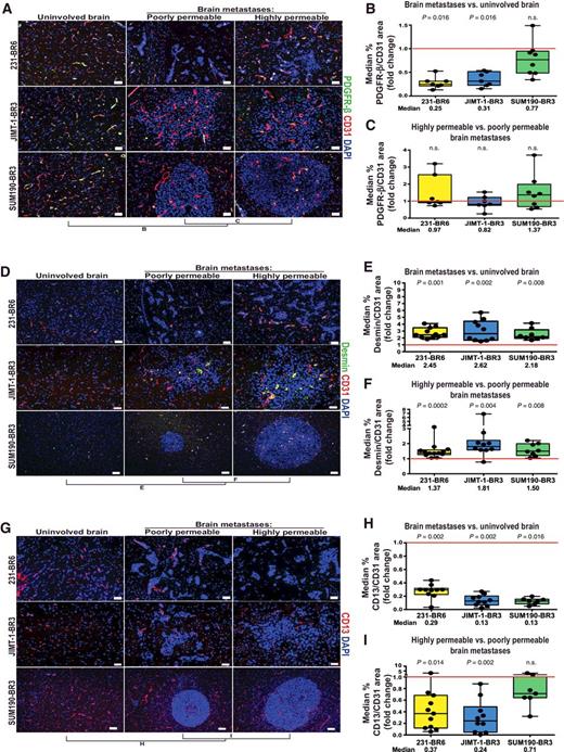 Alterations in Pericyte Subpopulations Are Associated with Elevated ...