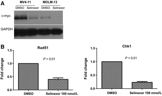 XPO1 Inhibition using Selinexor Synergizes with Chemotherapy in Acute Myeloid Leukemia by ...