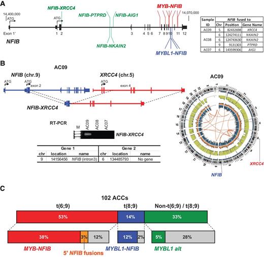 Novel MYBL1 Gene Rearrangements with Recurrent MYBL1–NFIB Fusions in ...