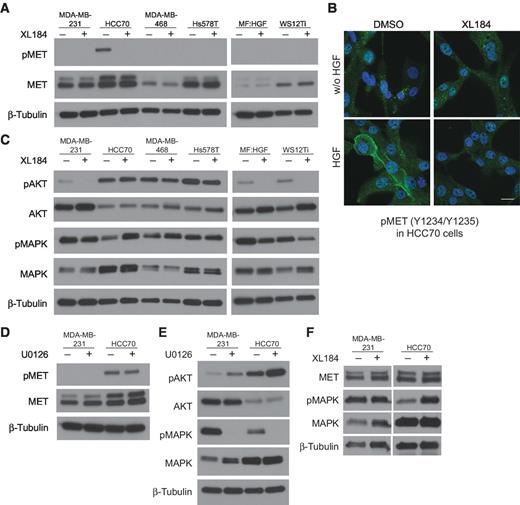 Cabozantinib (XL184) Inhibits Growth and Invasion of Preclinical TNBC ...