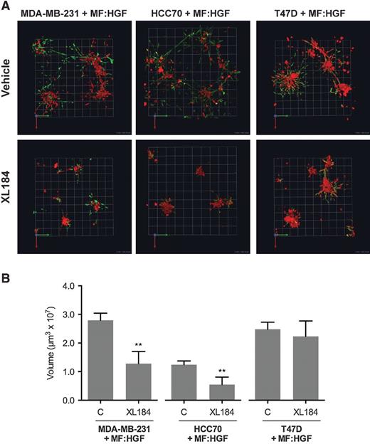 Cabozantinib (XL184) Inhibits Growth and Invasion of Preclinical TNBC ...