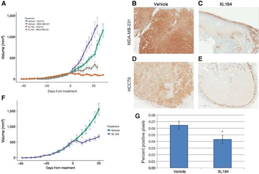 Cabozantinib (XL184) Inhibits Growth and Invasion of Preclinical TNBC ...