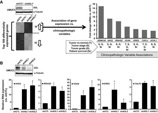 Loss of Glycogen Debranching Enzyme AGL Drives Bladder Tumor Growth via ...
