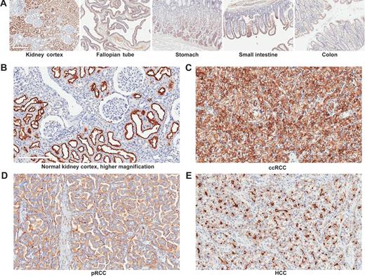 AGS16F Is a Novel Antibody Drug Conjugate Directed against ENPP3 for ...