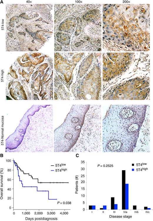 5T4-Targeted Therapy Ablates Cancer Stem Cells and Prevents Recurrence ...