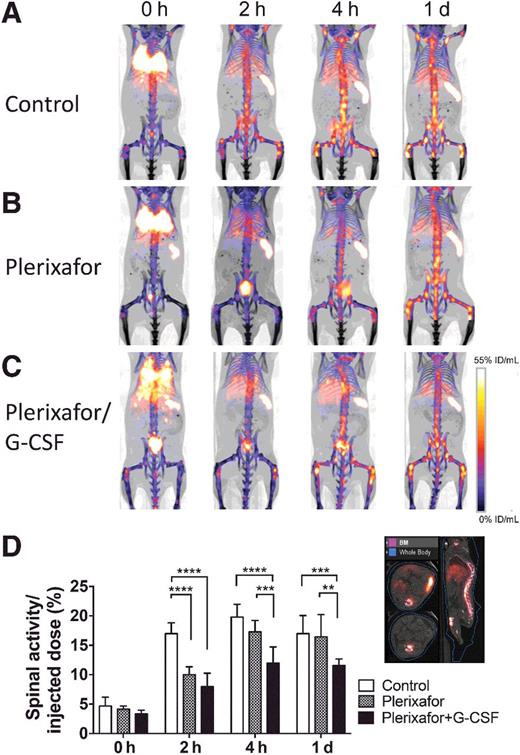 Bone Marrow Cell Trafficking Analyzed by 89Zr-oxine Positron Emission ...