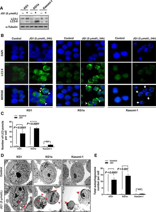 AMPK–ULK1-Mediated Autophagy Confers Resistance to BET Inhibitor JQ1 in ...