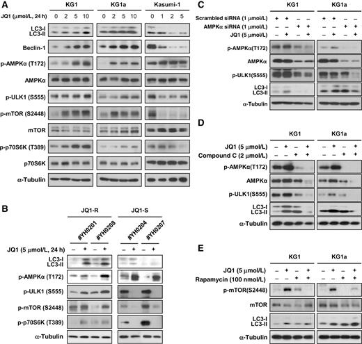 AMPK–ULK1-Mediated Autophagy Confers Resistance to BET Inhibitor JQ1 in ...