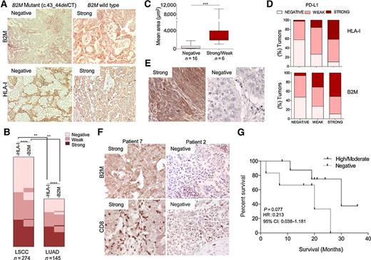 Genomic Profiling of Patient-Derived Xenografts for Lung Cancer ...