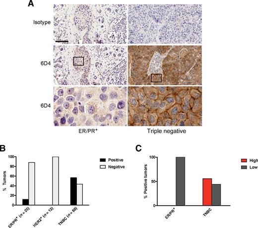 Analysis of ROR1 Protein Expression in Human Cancer and Normal Tissues ...