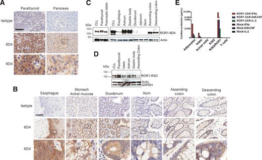 Analysis of ROR1 Protein Expression in Human Cancer and Normal Tissues ...