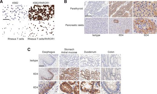 Analysis of ROR1 Protein Expression in Human Cancer and Normal Tissues ...