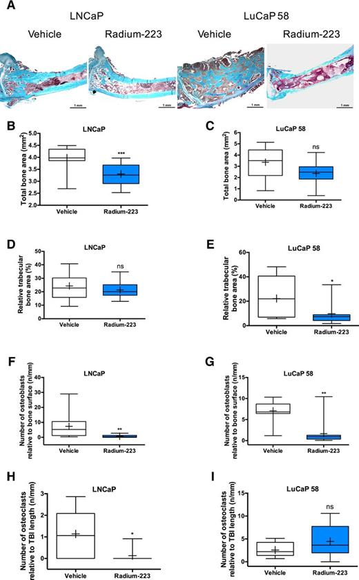 Radium-223 Inhibits Osseous Prostate Cancer Growth by Dual Targeting of ...