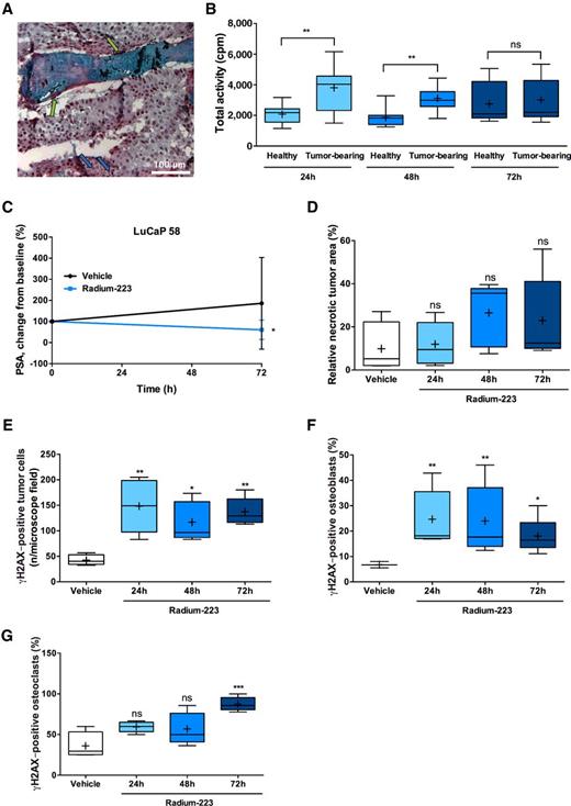 Radium-223 Inhibits Osseous Prostate Cancer Growth by Dual Targeting of ...