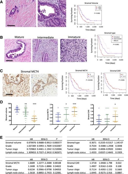 Stratification of Pancreatic Ductal Adenocarcinoma: Combinatorial ...