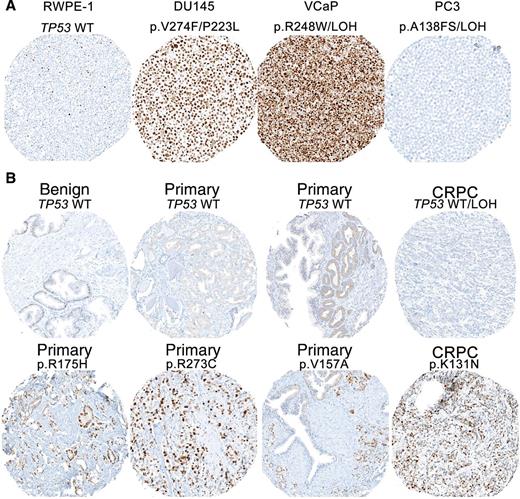 Analytic, Preanalytic, and Clinical Validation of p53 IHC for Detection ...