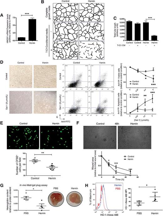 In Vivo Hemin Conditioning Targets the Vascular and Immunologic ...