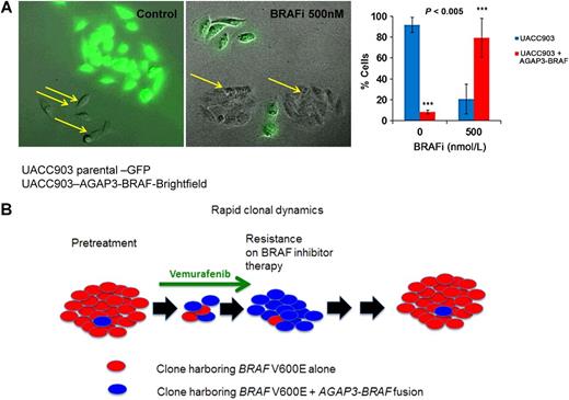 BRAF Fusion as a Novel Mechanism of Acquired Resistance to Vemurafenib ...