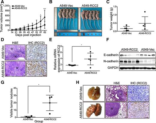 Overexpression of RCC2 Enhances Cell Motility and Promotes Tumor ...