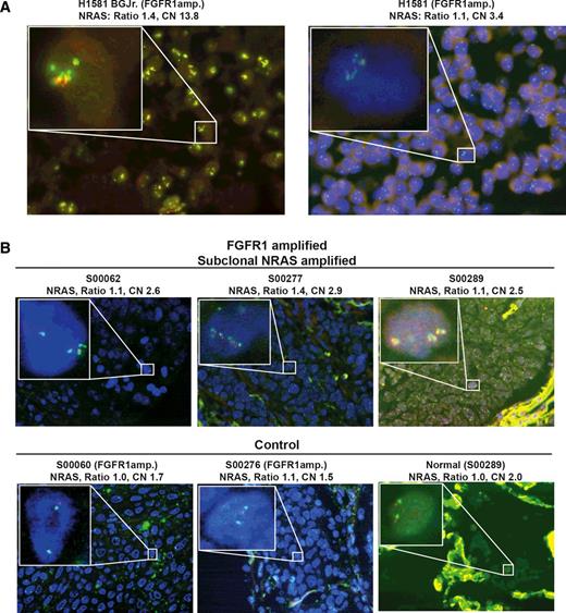 Mechanisms of Primary Drug Resistance in FGFR1-Amplified Lung Cancer ...