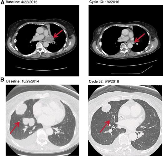 Phase Ib Study of Utomilumab (PF-05082566), a 4-1BB/CD137 Agonist, in ...