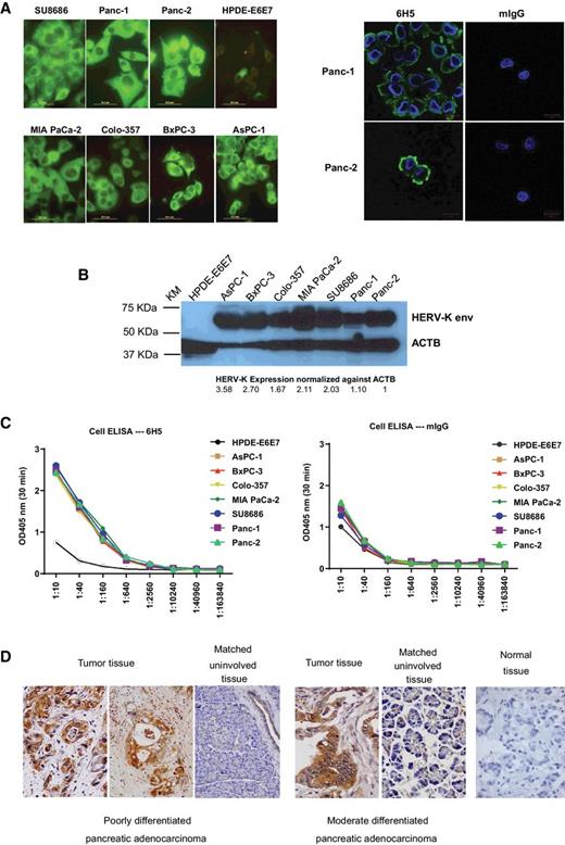 Downregulation of Human Endogenous Retrovirus Type K (HERV-K) Viral env ...