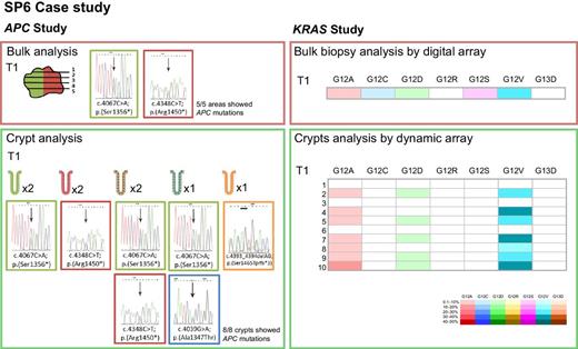 Mutational Heterogeneity in APC and KRAS Arises at the Crypt Level and ...