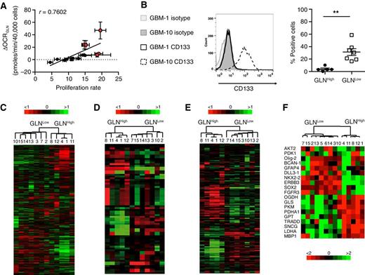 Efficient Mitochondrial Glutamine Targeting Prevails Over Glioblastoma ...