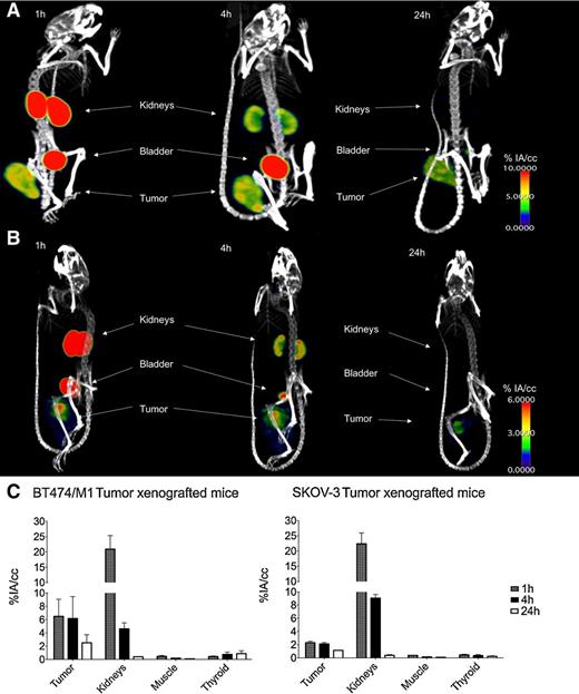 131I-labeled Anti-HER2 Camelid sdAb as a Theranostic Tool in Cancer ...