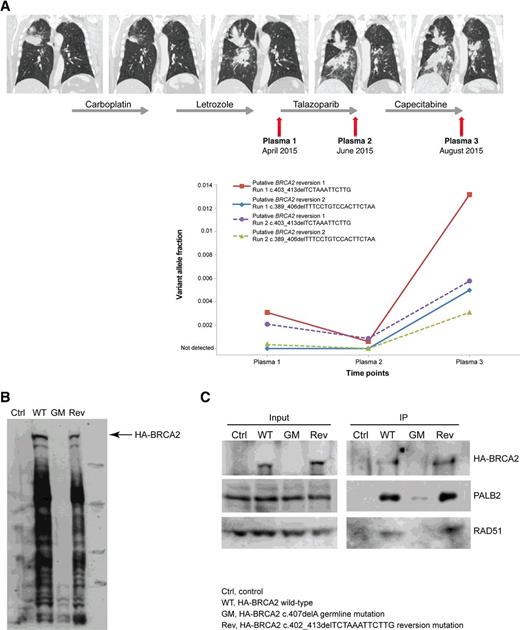 Diverse BRCA1 and BRCA2 Reversion Mutations in Circulating Cell-Free ...