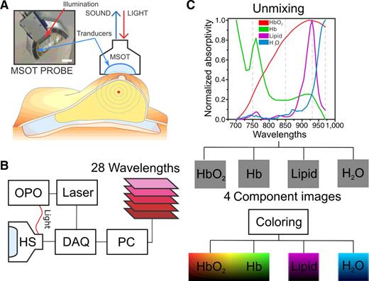 Multispectral Optoacoustic Tomography (MSOT) of Human Breast Cancer ...