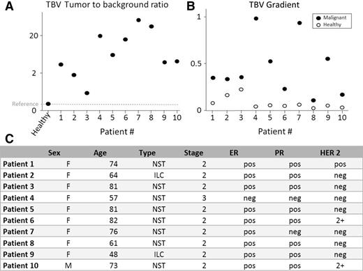 Multispectral Optoacoustic Tomography (MSOT) of Human Breast Cancer ...