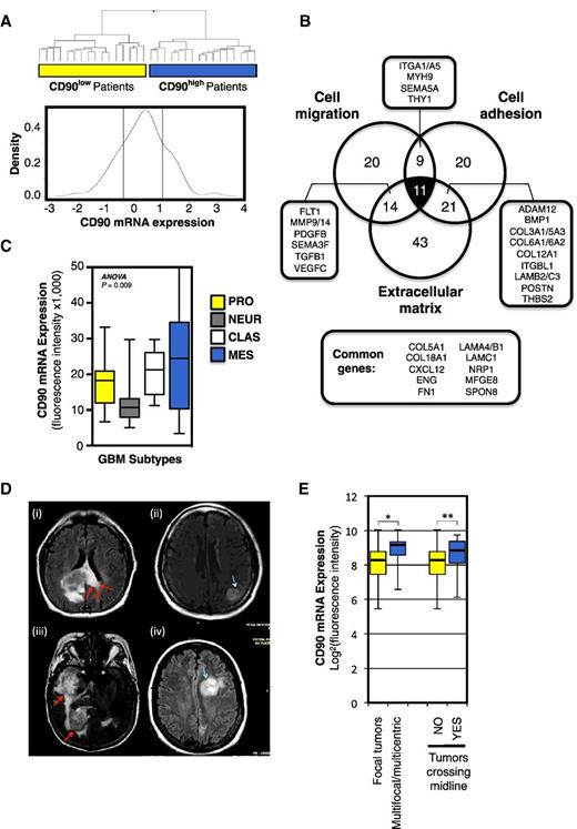 CD90 Expression Controls Migration and Predicts Dasatinib Response in ...
