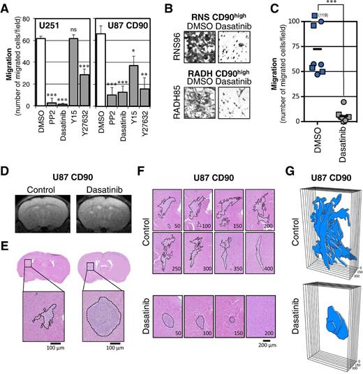 CD90 Expression Controls Migration and Predicts Dasatinib Response in ...
