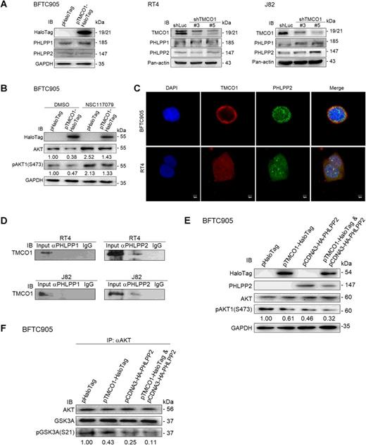 Transmembrane and Coiled-Coil Domain 1 Impairs the AKT Signaling ...