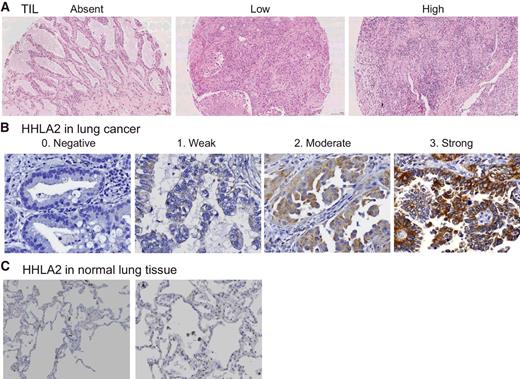 HHLA2, a New Immune Checkpoint Member of the B7 Family, Is Widely ...
