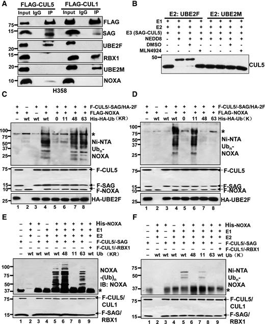 Neddylation E2 UBE2F Promotes the Survival of Lung Cancer Cells by ...