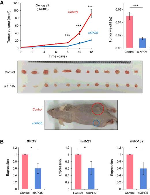 Exportin-5 Functions as an Oncogene and a Potential Therapeutic Target ...