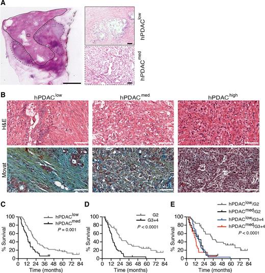 Co-clinical Assessment of Tumor Cellularity in Pancreatic Cancer ...