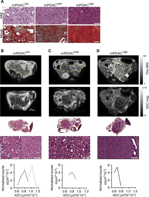 Co-clinical Assessment of Tumor Cellularity in Pancreatic Cancer ...