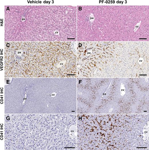 Liver Microvascular Injury and Thrombocytopenia of Antibody ...