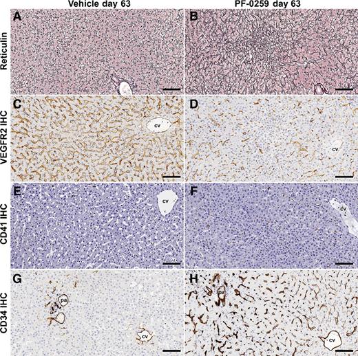 Liver Microvascular Injury and Thrombocytopenia of Antibody ...